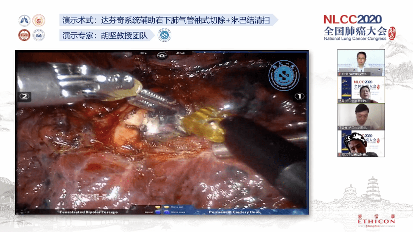 免疫靶向多源并进，开启肺癌治疗新时代 | 全国肺癌大会（NLCC 2020）顺利召开-搜狐大视野-搜狐新闻