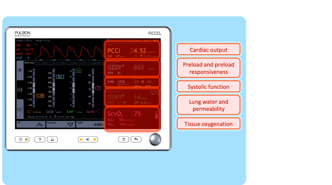 PiCCO在ICU中的应用_进行