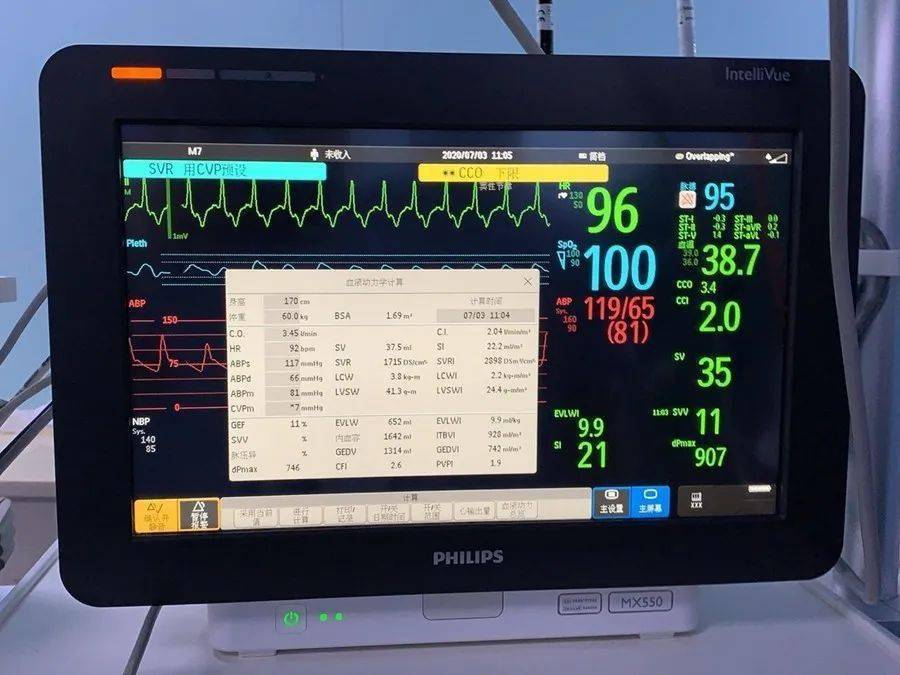 【科室动态】我院ICU开展PICCO监测新技术，重症救治能力再上新台阶！_患者