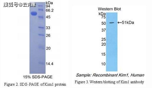 肾损伤分子-1（KIM-1）——肾病早期的重要指标_Kim-