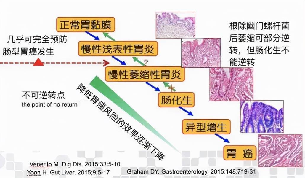 喝酒喝到胃出血怎么办,事后怎么调理胃部