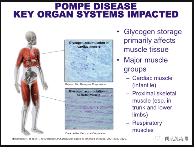 Centyrin-siRNA 偶联物的重大突破： Aro更新数据证明ABX1100治疗庞贝病的潜力_药物_疾病_疗法