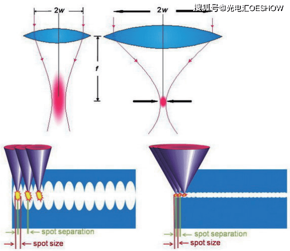被「吹上天」的近视手术，为什么很多眼科医生自己都不做？_激光_角膜_脉冲