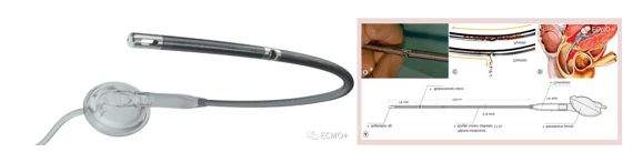 人工心脏5——一文浅析短期PVAD（下）_Impella_主动脉_导管