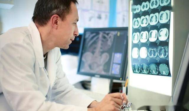 PEC-CT检查是什么？在诊断肿瘤时，会有被误诊的风险吗？_手术