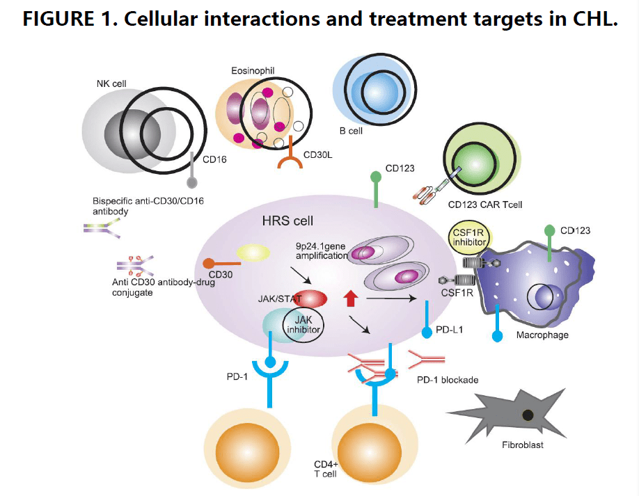CD30学院 | 饶慧兰教授——霍奇金淋巴瘤病理诊断_饶教授