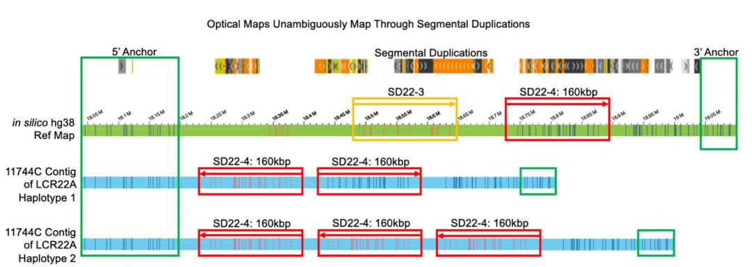 【有突破，不“遗”憾】22q11.2微缺失综合征_Bionano