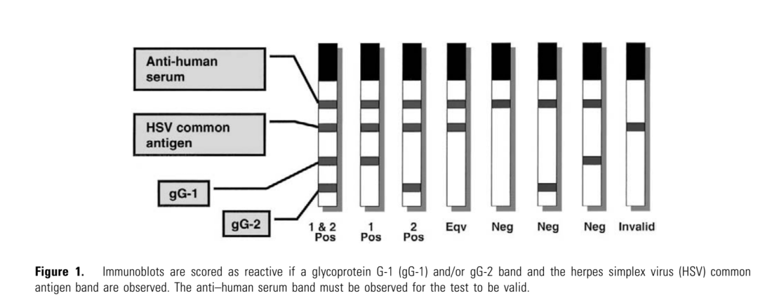HSV感染的免疫应答与抗原选择策略_检测