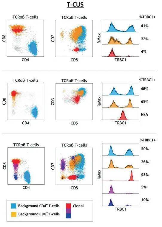 意义未明的T细胞克隆性增殖（T-CUS）并不少见，大家需关注_检测