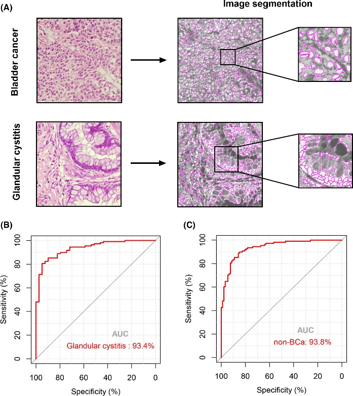 相见恨晚！病理组学入门级玩法就能发篇代表作？_诊断_图像_研究