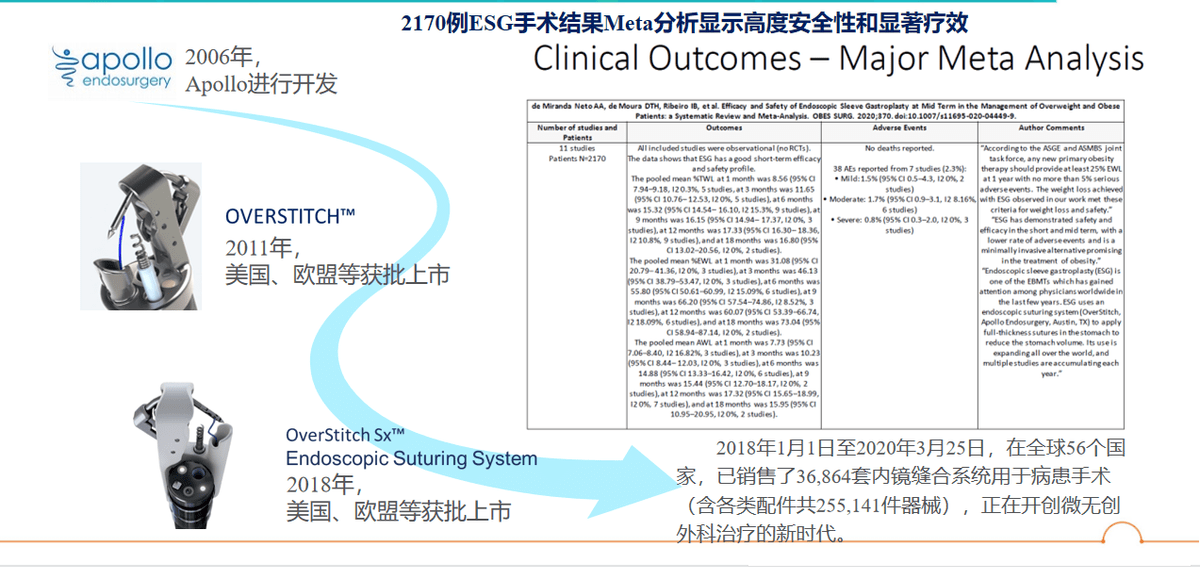 国内首例 | 吴良平教授减重团队成功实施ESG内镜下袖状胃成形术_手术_代谢_患者