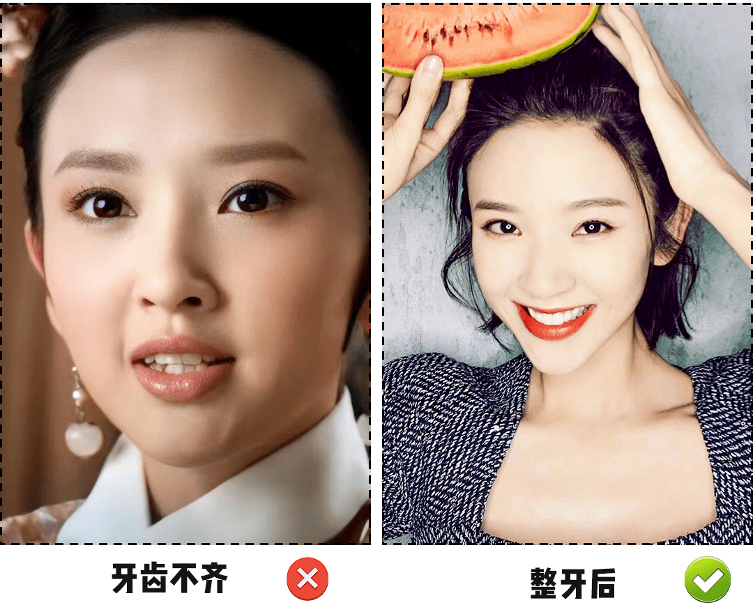 FM95.4《生活家》直播 | 矫正大咖与你面对面_牙齿_数字化_口腔