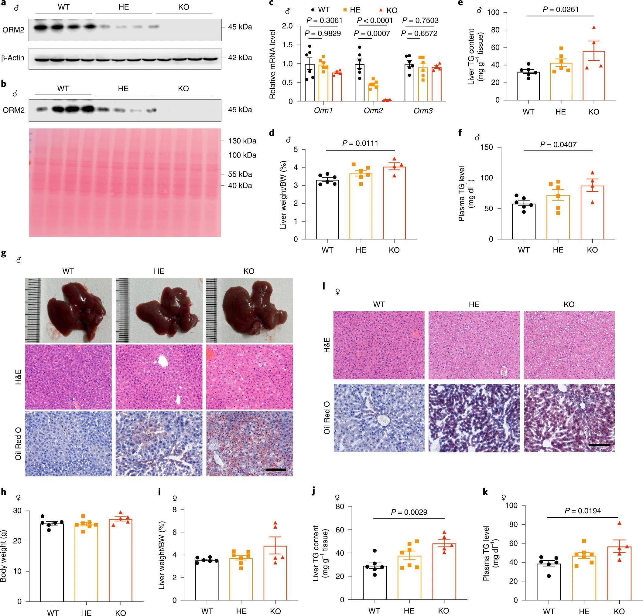云序用户文章|IF=19.865，多组学分析助力非酒精性脂肪性肝病发病机制研究_肝脏_水平_分析