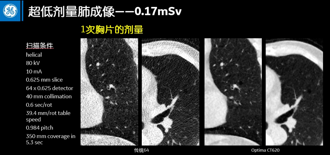 疾病诊断又添“侦察兵”！Optima CT620上线-搜狐大视野-搜狐新闻