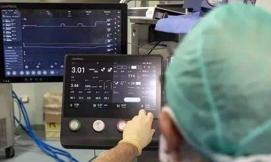 LivaNova的新一代ECMO设备Essenz获批FDA！_系统_灌注_患者