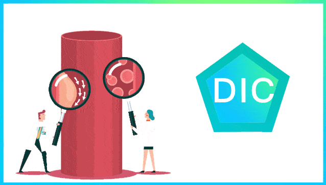 世界子痫前期日科普之十二——DIC_应用_补充_基础