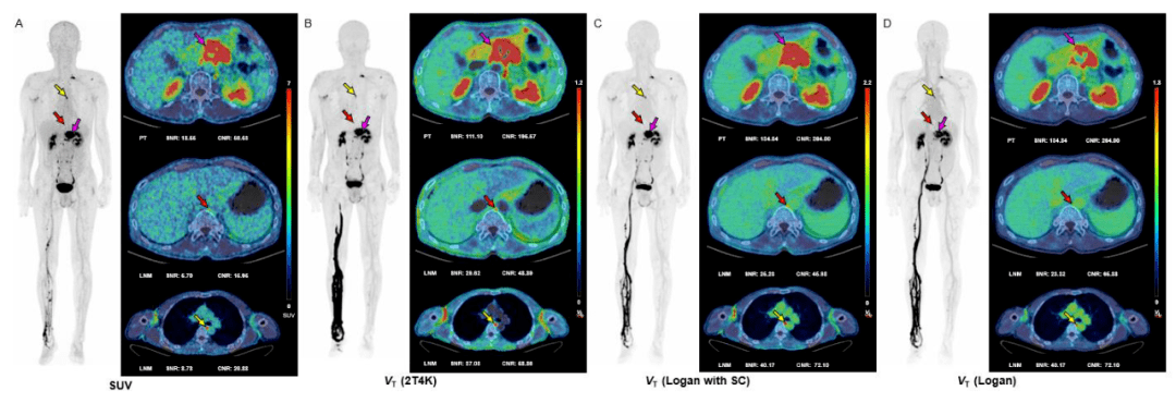 【学术】仁济核医学科 | Total-body PET/CT最新研究成果_成像_应用_方面