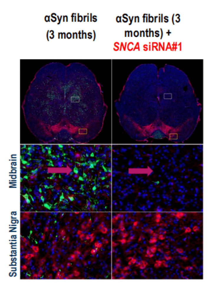Alnylam：三驾马车将RNAi推向更广泛的适应症_基因组_siRNA_疾病